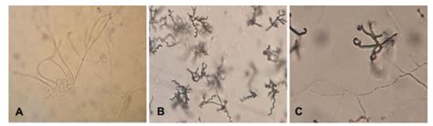 Spore Chain Morphology Of Streptomyces Light Microscopy 1000 X A