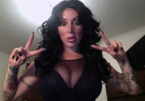 Micky Syndrome Looks Like The Singer Cher Here See Sexblooddd