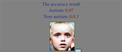 The Autism Detection Web Page Download Scientific Diagram