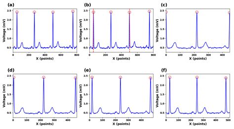 Electrocardiogram Based Biometric Identification Using Mixed Feature Extraction And Sparse