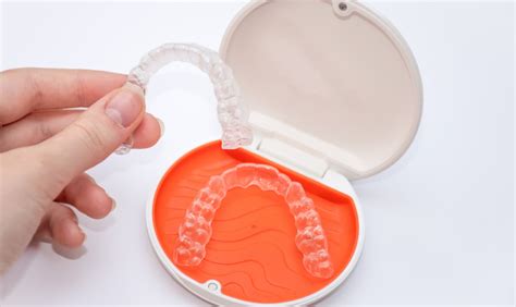Signs That You Need Invisalign And Clear Aligners