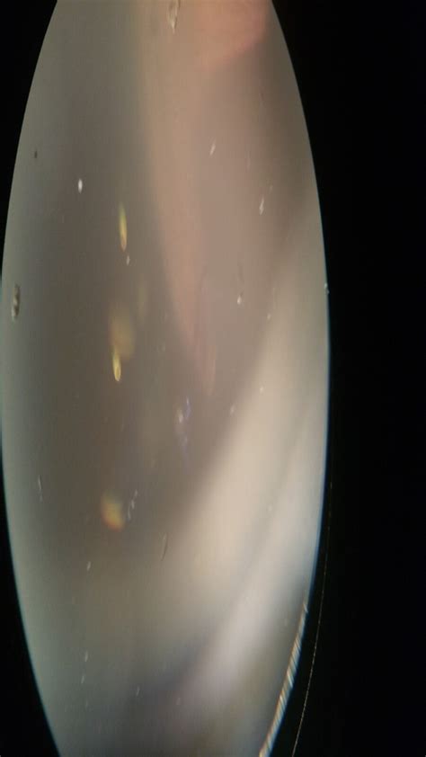 Classified Items Received Photo Gallery Cloudy Nights