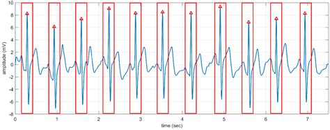 Heartprint A Dataset Of Multisession Ecg Signal With Long Interval Captured From Fingers For