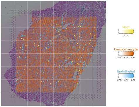 30 Spatial Deconvolution — Single Cell Best Practices