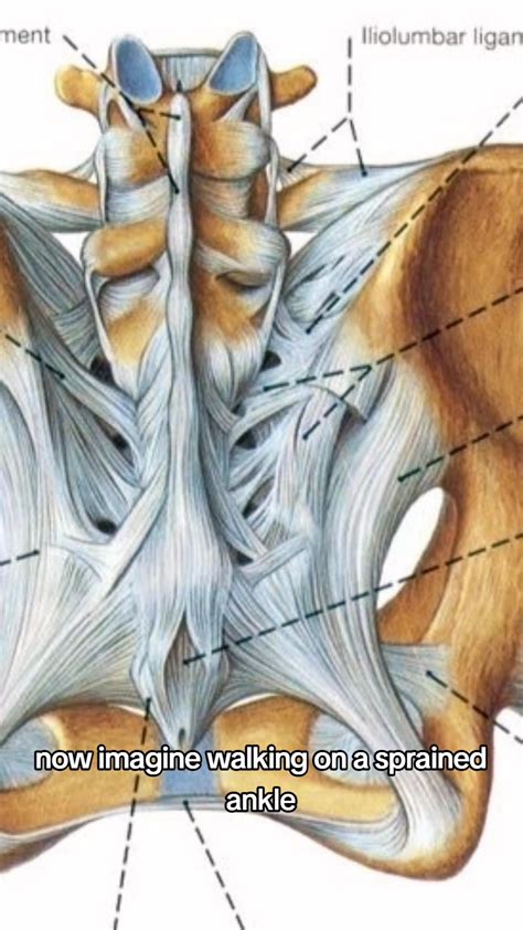 Iliolumbar Ligament Treatment Iliolumbar Ligament Tears Avoid Surgery