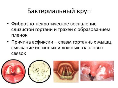 Обструкция дыхательных путей презентация онлайн