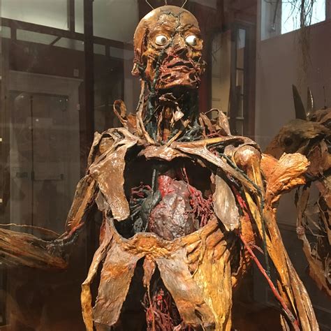 Flayed Man Found In The Musée Fragonard Dalfort Paris Rcreepy