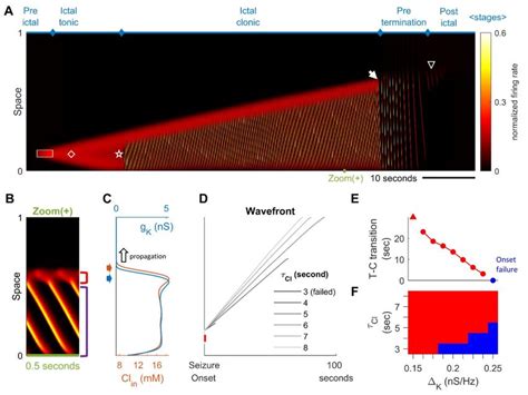 Stages Of Focal Seizure Evolution In A 1d Model A Spatiotemporal