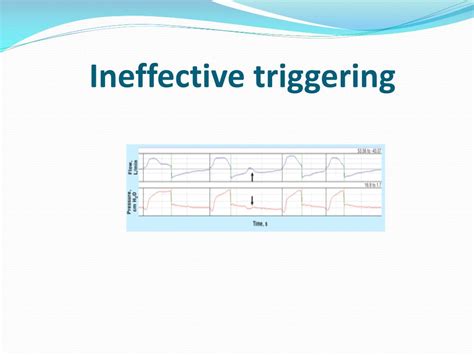 Ppt Patient Ventilator Interaction Triggering And Flow Problems