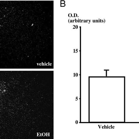 A Effect Of The Icv Injection Of Alcohol 5 L Of 200 Proof 86 Mol On Download Scientific