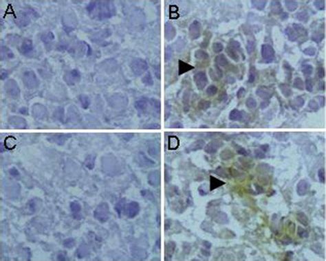 Detection The Intracranial Igg In Mice After Intravenous Injection The Download Scientific