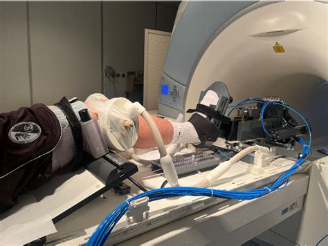 Figure 1 From Validation Of A Finite Element Simulation For Predicting