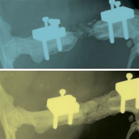 Cutting Edge Bioengineering For Musculoskeletal Regeneration The Focus