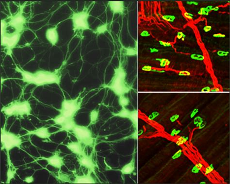 Physio Pathogenic Mechanisms In Differentiation