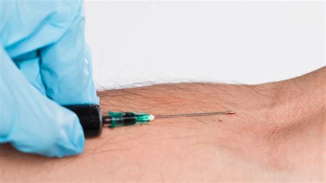 Trigger Point Injection Kinesis Pain Speciality Centre