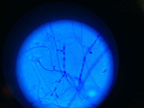 Coccidioides Immitis Alternating Barrel Shaped Arthroconidia
