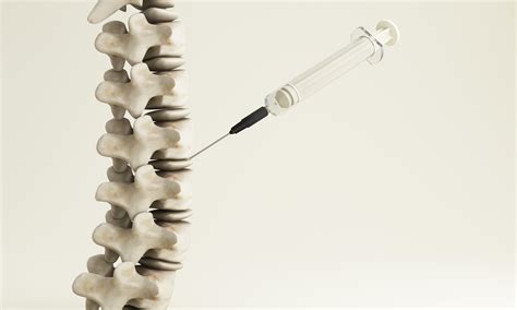 What If Steroid Injections Dont Work For Bulging Disc At Daryl Hudson Blog