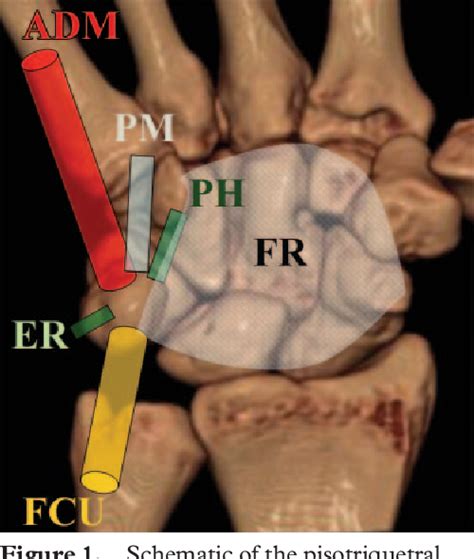 Structure Of Pisiform Bone Of Hand Semantic Scholar