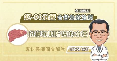 釔 90治療合併免疫治療扭轉晚期肝癌的命運，專科醫師圖文解說 Beanfun
