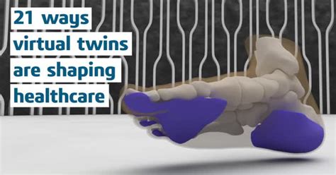 Video Dassault Systèmes On Linkedin 21 Ways Medical Digital Twins