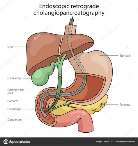 Endoscopic Retrograde Cholangiopancreatography Structure Vertebral Column Diagram Hand Drawn