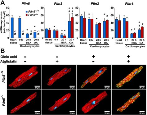 Mrna Expression Of Plin2 5 And Ld Storage In Isolated Cardiomyocytes
