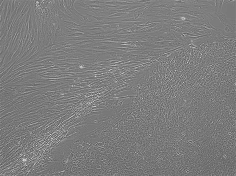 How To Isolate Keratinocytes From Fibroblasts In A Co Culture Using Medium Researchgate