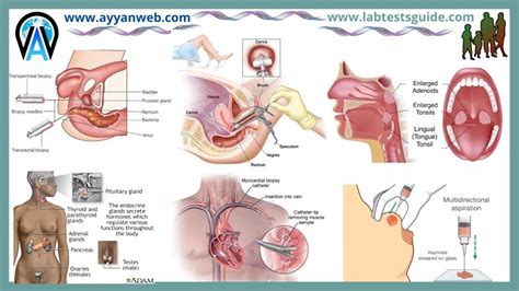 List Of Lab Tests Normal Values With Conventional And SI Units LTG