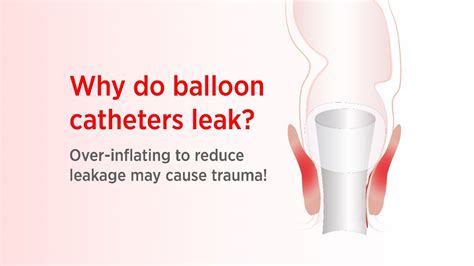 Inflate Balloon Catheter