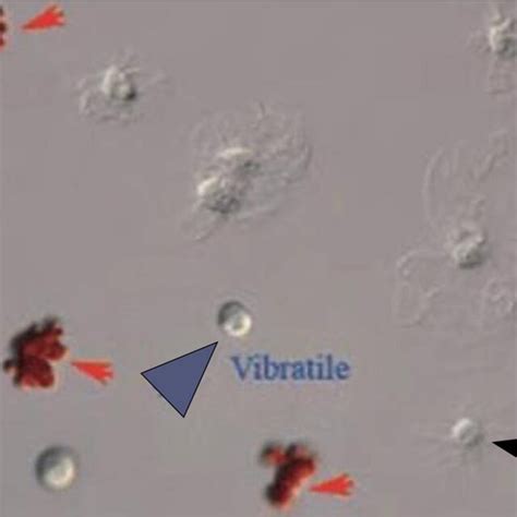 Types Of Coelomocytes In Echinoderms Red Arrow Red Spherule Cells Download Scientific
