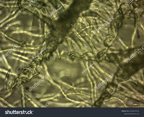 Trichoderma Vs Fusarium Dual Culture Pda Stock Illustration 2222675531
