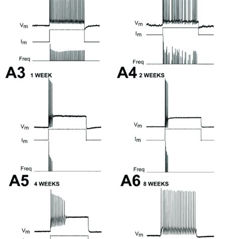 Examples Of Time Course Of Altered Firing Patterns For Rs Neurons