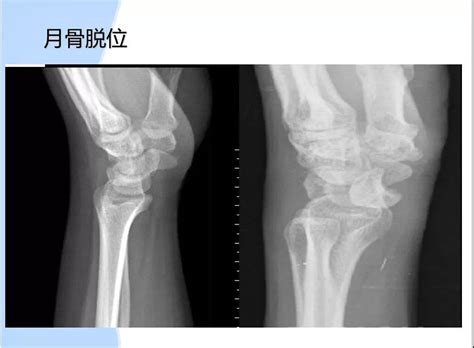 这几个常见的神经卡压综合征，你会诊治几种？ 德医学院 助力医学教育发展！
