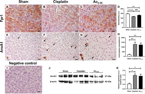 Expression Of Fpr1 And Anxa1 In Liver A C Intense Expression Of Fpr1