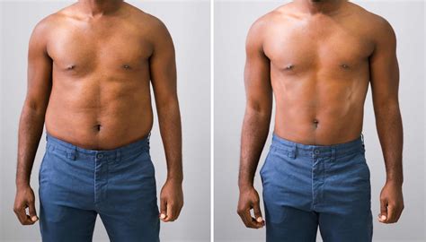 Semaglutide Injections For Medical Weight Loss In Twin Falls Idaho