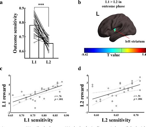 Figure 1 From The Right Superior Temporal Gyrus Plays A Role In