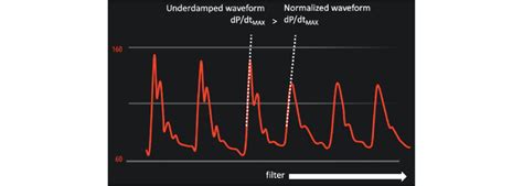 Typical Underdamped Arterial Pressure Waveform Before And After Download Scientific Diagram