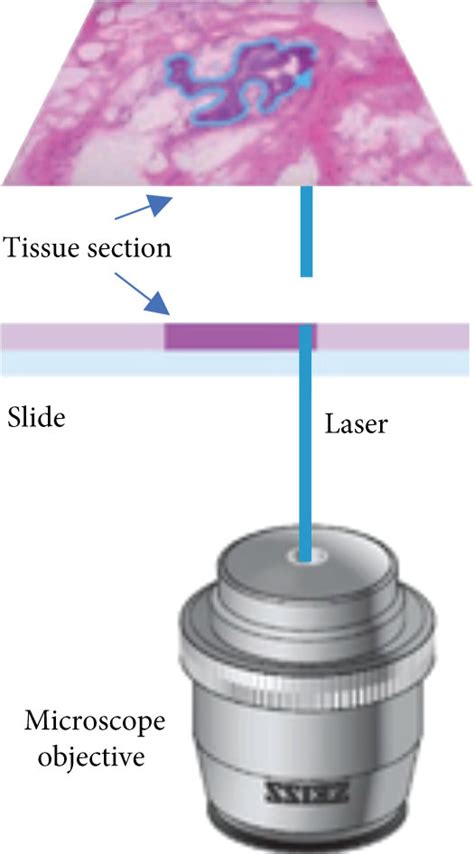 Inverted Microscope Used In Laser Microbeam Lmm And Laser Capture