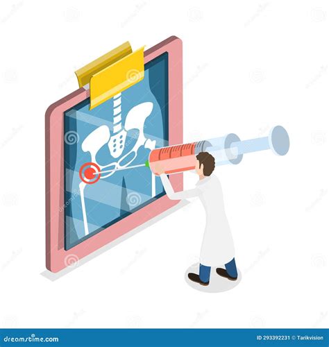 3d Isometric Flat Vector Illustration Of Hip Joint Cortisone Injection Item 3 Stock Vector