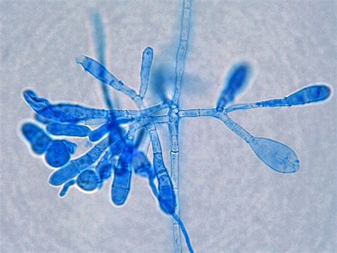 Fun With Microbiology Whats Buggin You Epidermophyton Floccosum