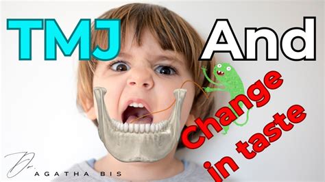 Tmj Disorder And Panorex Smile By Bis
