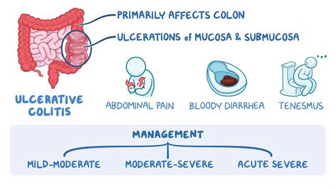 Ulcerative Colitis Diagnosis
