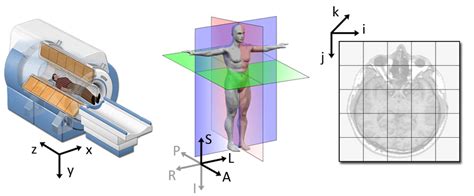 Coordinate Systems Slicer Wiki