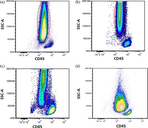 Acute Promyelocytic Leukemia Immunophenotype And Differential