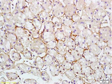 Anti Rab7 Antibody Ab217856 Abcam