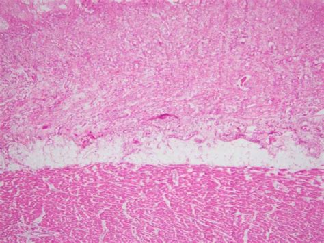 切片学习 常规病理组织切片及诊断要点 微诊网 检验医学新媒体 Weivd Com