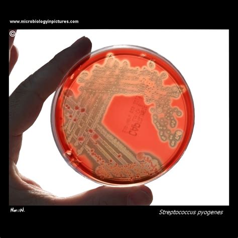 Streptococcus Pyogenes Group A Streptococcus Gas