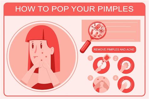 Premium Vector How To Pop Pimple Infographics Vector Cartoon Illustration
