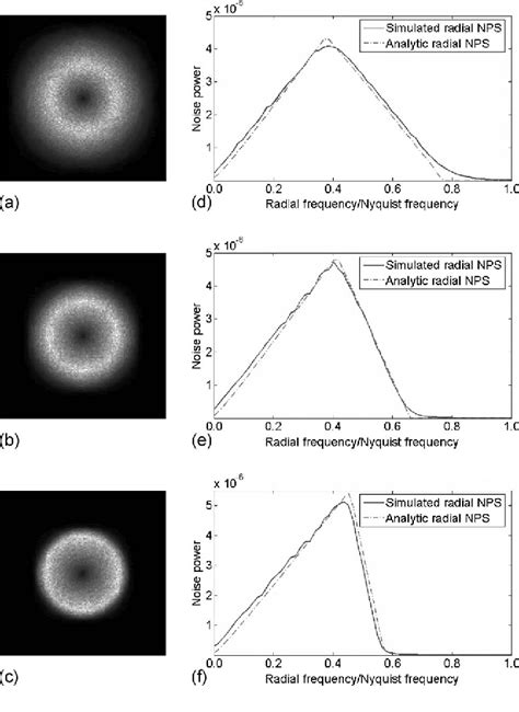 Figure 9 From The Noise Power Spectrum In Ct With Direct Fan Beam Reconstruction Semantic Scholar