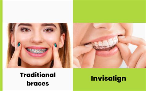 What Does An Invisalign Retainer Look Like Sentinel Mouthguards®